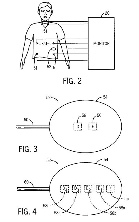 Patent US Bioimpedance System And Sensor And Technique For Using The Same Google Patents