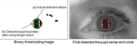 Pupil Boundary Detection With The Ellipse Fitting Method Left Image