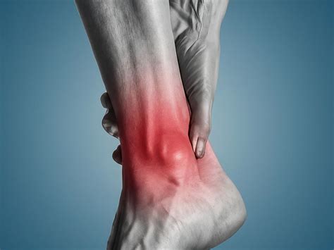 Anterior Ankle Pain Common Causes And Treatment Options Miss Ella