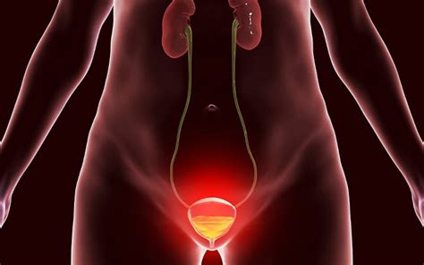 Organ Sparing Bladder Surgery Lets Cancer Patient Enjoy Life