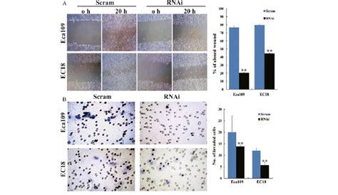 Src 3 Enhances Escc Cell Migration And Invasion A The Representative