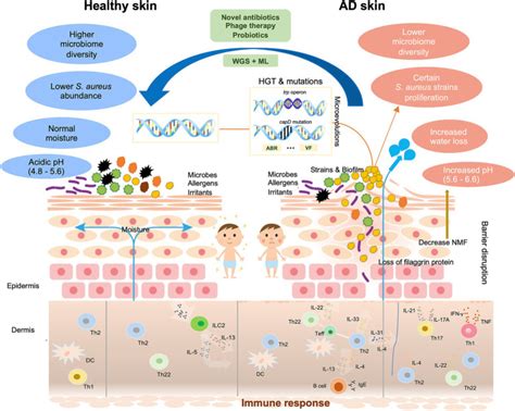 Staphylococcus Aureus In Atopic Dermatitis Past Present And Future