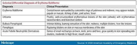 Erythema Migrans Vs Erythema Multiforme