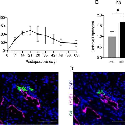 postoperative upregulated c3 expression and complement activation in