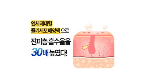 줄기세포 탈모치료제 리맨틱