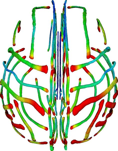 3 Sulcal Variability Top The Sulcal Lines Alone Mean Curves Are