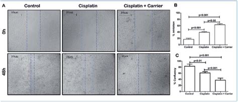 Effect Of Cisplatin Carrier As Tripta Cisplatin On Cell Migration In