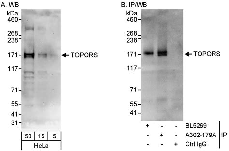 Topors Antibody A302 179a