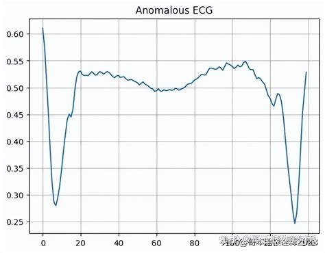 简单的基于自编码器的心电信号异常检测（tensorflow，keras） 知乎