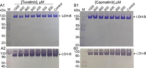 Figure 3 From Targeting Lactate Dehydrogenase B As A Strategy To Fight