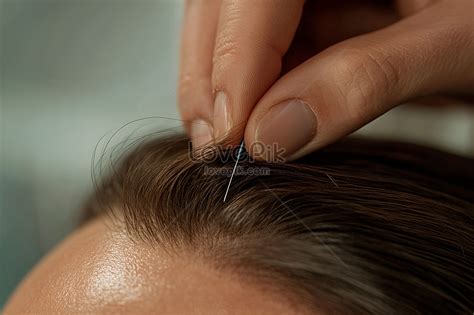Scalp Acupuncture Image And Picture For Free Download Lovepik
