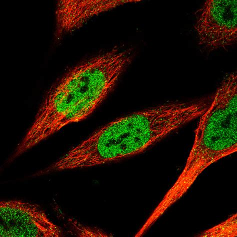 Mouse Monoclonal Anti Klf4 Antibody Buy For Research Highly