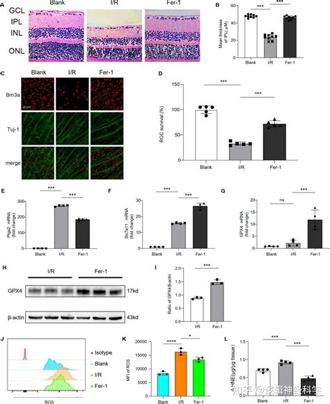 J Neuroinflammation︱中山大学中山眼科中心卓业鸿苏文如团队揭示铁死亡可能是视网膜缺血 再灌注的损伤新机制和治疗新靶点 知乎