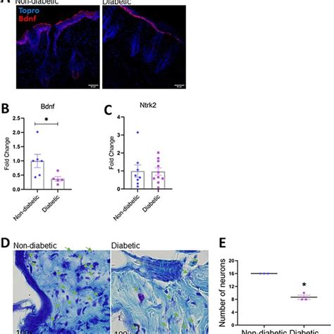 Evaluation Of Bdnf Ntrk2 And Peripheral Neurons In The Skin Of Download Scientific Diagram