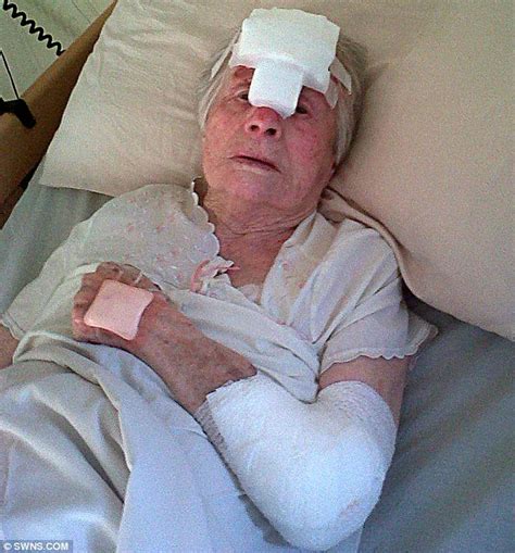 Great Grandmother 94 Suffers Horrific Injuries After Falling Out Of