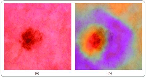 A Visual Illustration Of Localization Using Grad CAM A Shows The