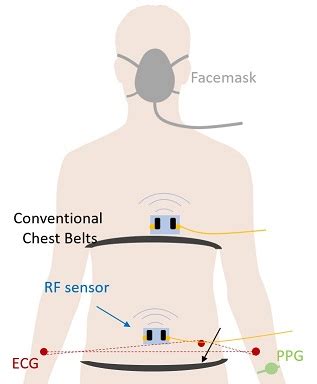 Wearable Near Field Radio Frequency Sensor For Cardio Pulmonary Monitoring RF Vital Sensing