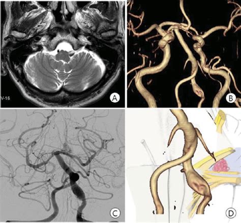 A T2 Weighted Axial Magnetic Resonance Mr Image B Download