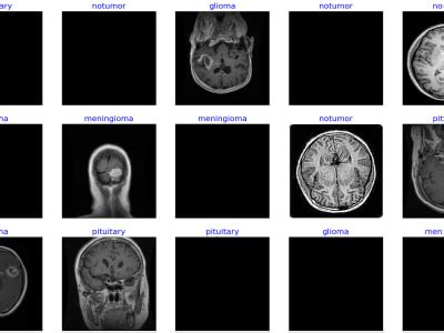 Brain Tumor Detection Through Transfer Learning Techniques Upwork