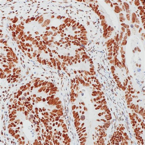Cytokeratin 20（ck20） 杭州百凌生物科技有限公司 官方网站