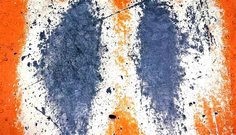 3d Model May Lead To New Pulmonary Fibrosis Treatments Futurity