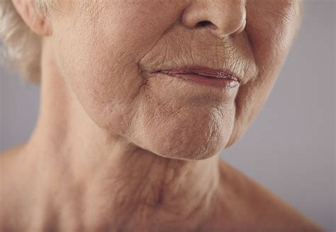 5 Ways To Erase Wrinkles Without Surgery