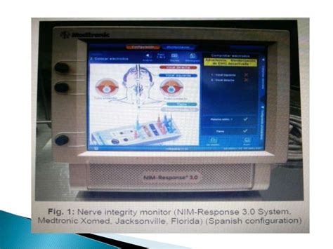 Intra Operative Nerve Monitoring In Ent