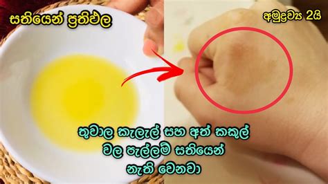 තුවාල කැලැල් සහ අත් කකුල් වල තියන පැල්ලම් සතියෙන් නැති කරන මැජික් එකක් මේක Yuwathitips Youtube