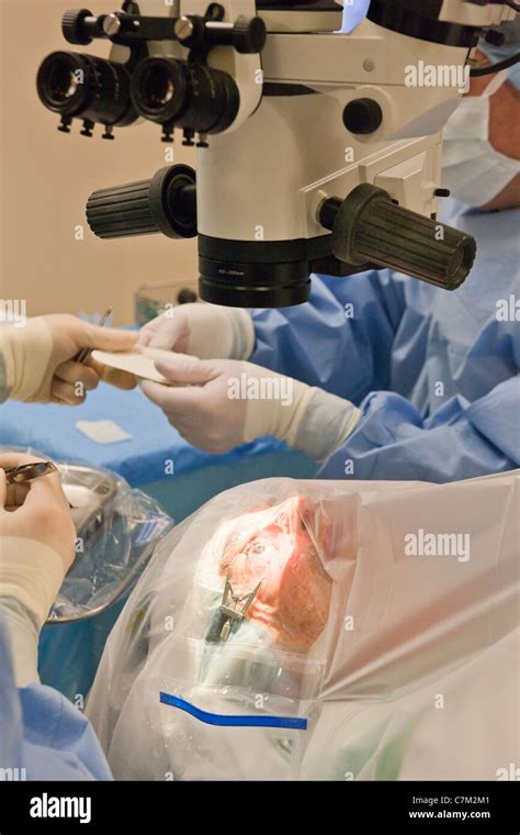 Suture Removal After Cataract Surgery At Piper Armit Blog