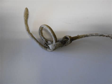 A Percutaneous Endoscopic Gastrostomy With A Knotted Jejunal Extension