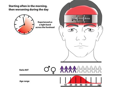 Trigger Point Therapy Tth Fact File Headache And More Niel Asher