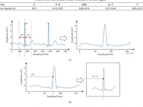 Table 2 From Arrhythmia Classification Algorithm Based On A Two