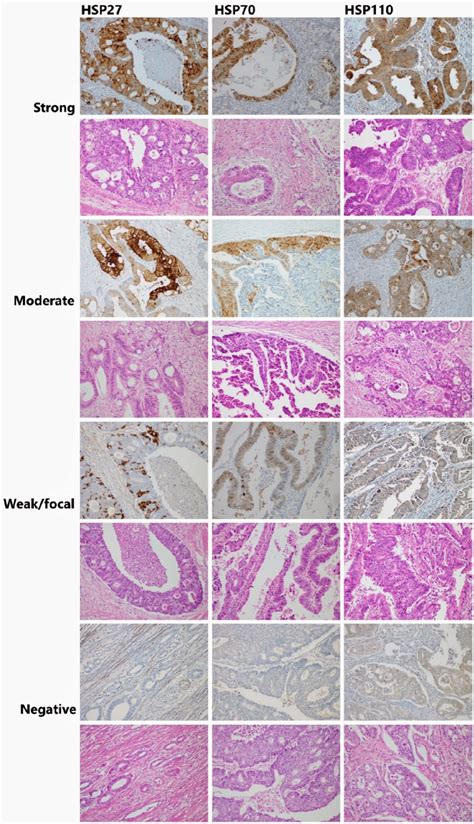 Histological Images Showing Various Conventional Colorectal