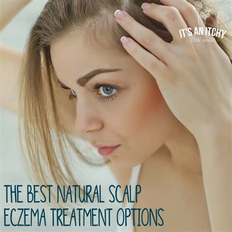 The Best Natural Scalp Eczema Treatment It S An Itchy Little World