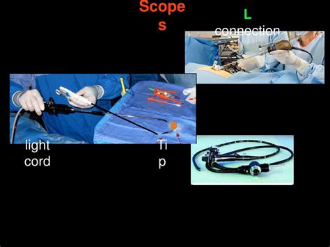 Ppt Laparoscopic Vs Sils Cholecystectomy Intraoperative Cholangiogram