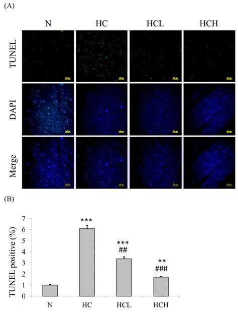 TUNEL And DAPI Staining To Detect Cardioapoptosis A DAPI And Download Scientific Diagram
