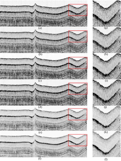Figure 3 From A Non Local Low Rank Algorithm For Sub Bottom Profile