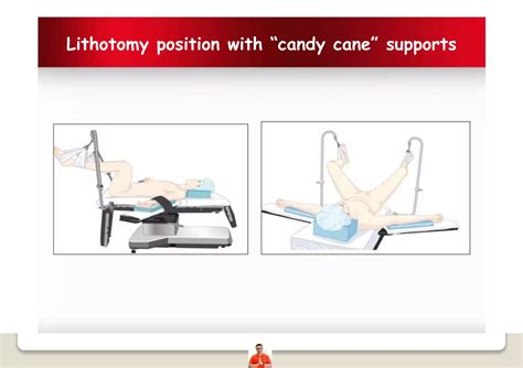 Patient Different Position Under Anesthesia Pptx