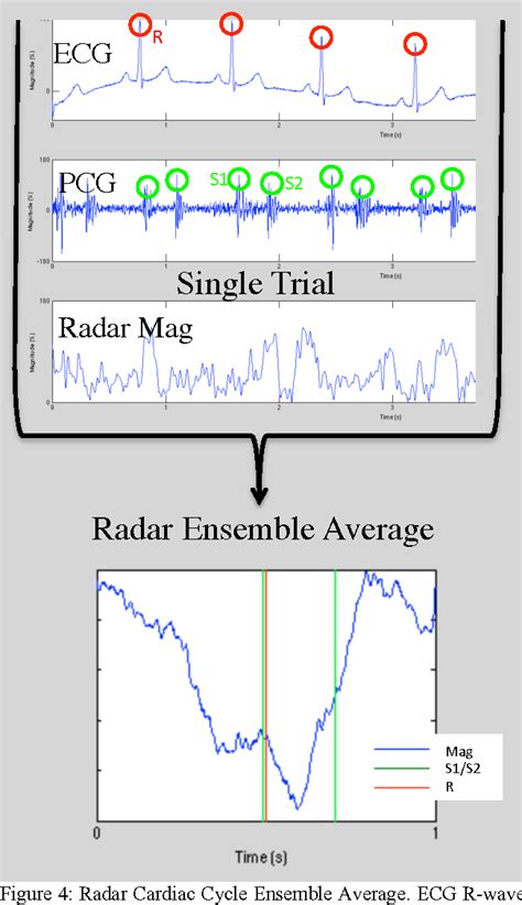 Figure 1 From Cardiac Radar For Biometric Identification Using Nearest Neighbour Of Continuous