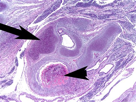 Examples Of Important Visual Cues In Histology Left In This Teratoma
