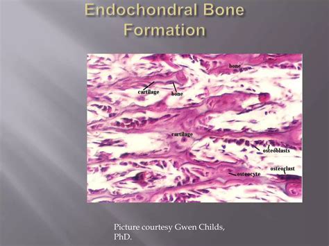 Pathophysiology Of Fracture Healing Pptx