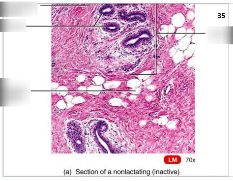 Lab Unit 3 Atlas Inactive Mammary Gland Histology Diagram Quizlet