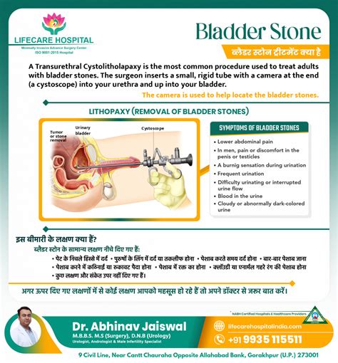 Bladder Stone Lifecare Hospital