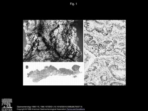 Volume 115 Issue 6 Pages December 1998 Ppt Download