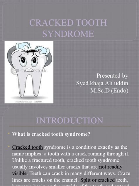 Cracked Tooth Syndrome