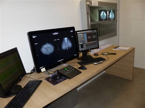 Mammographie [dépistage Du Cancer Du Sein] Examen Radiologique