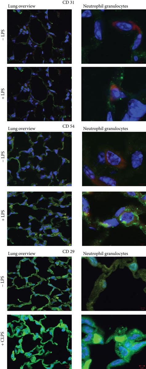 Migration Of Polymorphonuclear Neutrophils Pmns Into The Different