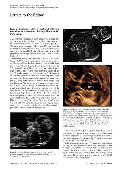 PDF Pitfalls In Diagnosis Of Uterine Artery Pseudoaneurysm After Cesarean Section DOKUMEN TIPS