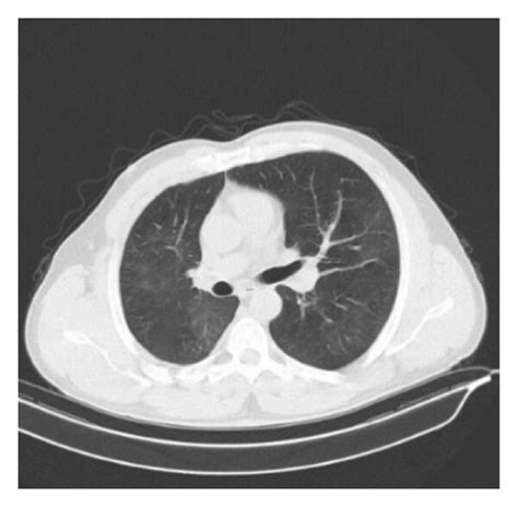 The Comparison Outcomes A Original Ct Image 5 B D Segmentation Download Scientific