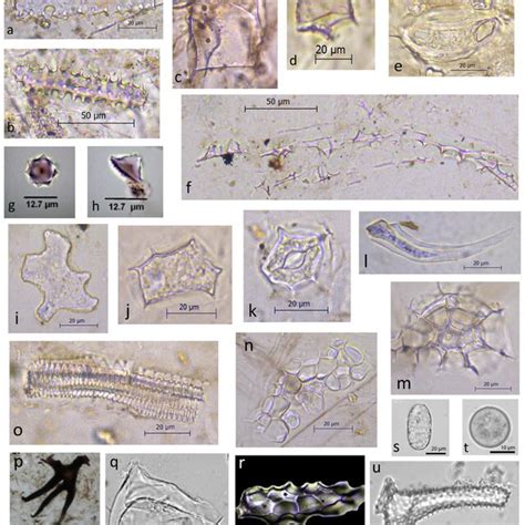 Specific Phytoliths Produced In Leaves Of Broad Leaf Trees Download